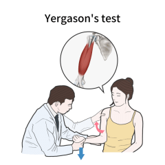 Yergason's test : callilife - 네이버 OGQ마켓